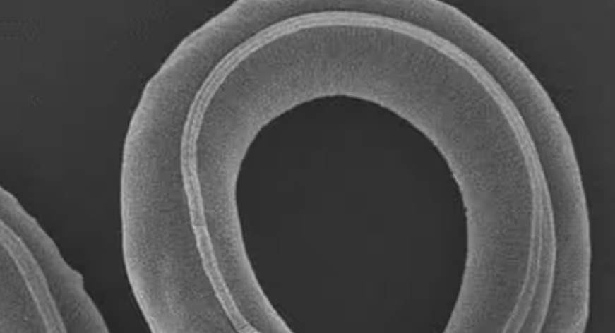 Scientists revive worm frozen for 46,000 years